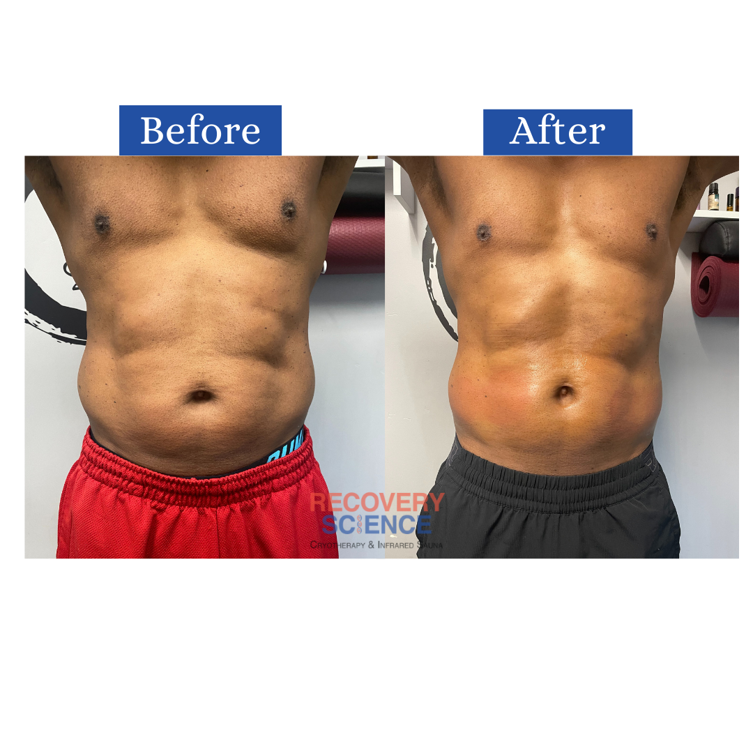 Recovery Science Inc. | Does Cryo T Shock Work? | Recovery Science Inc.